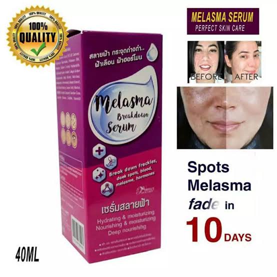 Perfect Skin Lady Melasma Breakdown Serum – Perth Affordable Beauties ...